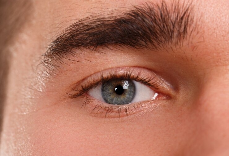 Hati-hati! Ini 5 Dampak Buruk Sering Mengucek Mata